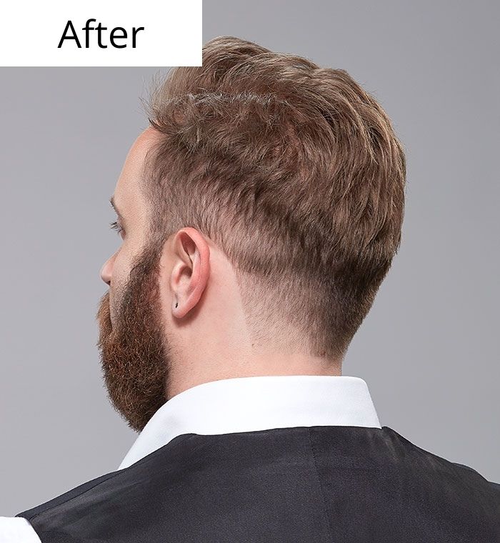 Bonded Toppers for Men | Tammy Lobato Pty Ltd