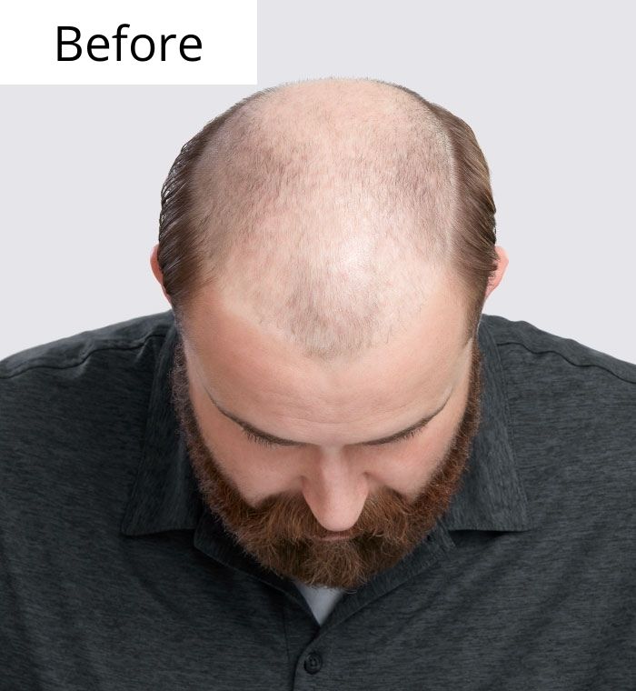 Bonded Toppers for Men | Tammy Lobato Pty Ltd