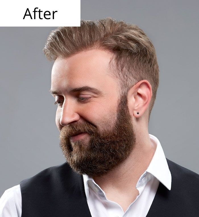 Bonded Toppers for Men | Tammy Lobato Pty Ltd