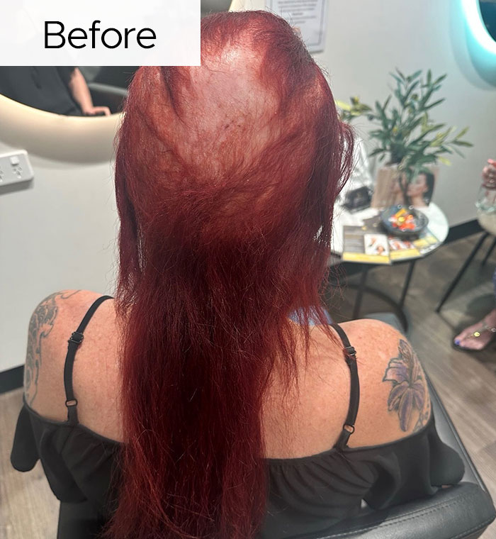 Hair Replacement (Bonded Systems) for Women | Tammy Lobato Pty Ltd